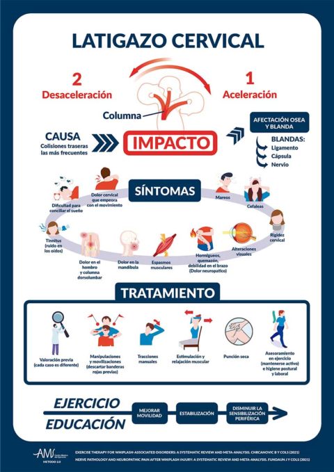 Latigazo Cervical - AMS Centro Médico del Ejercicio